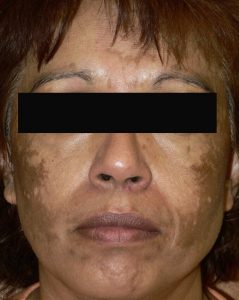 Dermacure London : The most exclusive Skin,Laser & Microblading Clinic